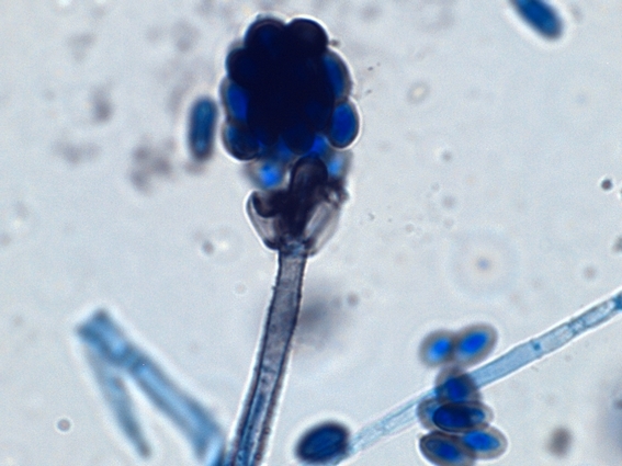 Fun With Microbiology (What's Buggin' You?): Stachybotrys species