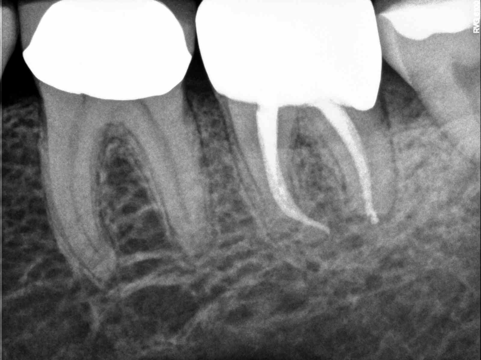 WM 51 - Bauer Smiles