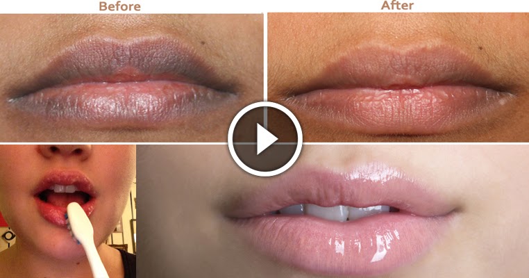 Home DIY - How To Lighten Darker Lips And Get Pink Lips! - Style Hunt World