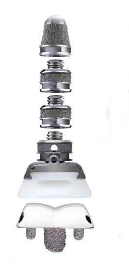 The Daily Fix: Wright Medical Announces Launch of Inbone II Ankle Implant