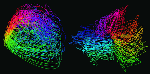 Our Parkinson's Place: Creating a Perfect Brain Storm
