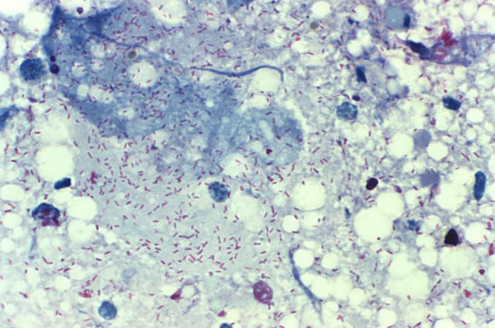 Rickettsia Rickettsii Gram Stain