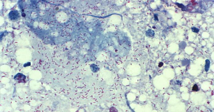 MCQs on Rickettsiae and bacterial zoonotic diseases- obligate ...