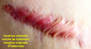 DERMATOLOGIA APROAPE DE TINE CABINET DERMATOLOGIE IASI DERMATOLOG ...