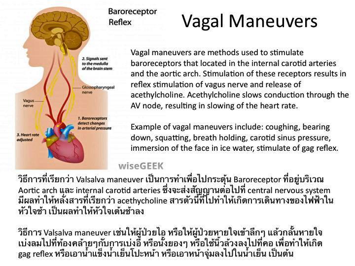 Valsalva maneuver