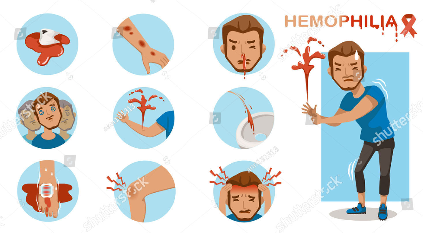 Hemophilia Person
