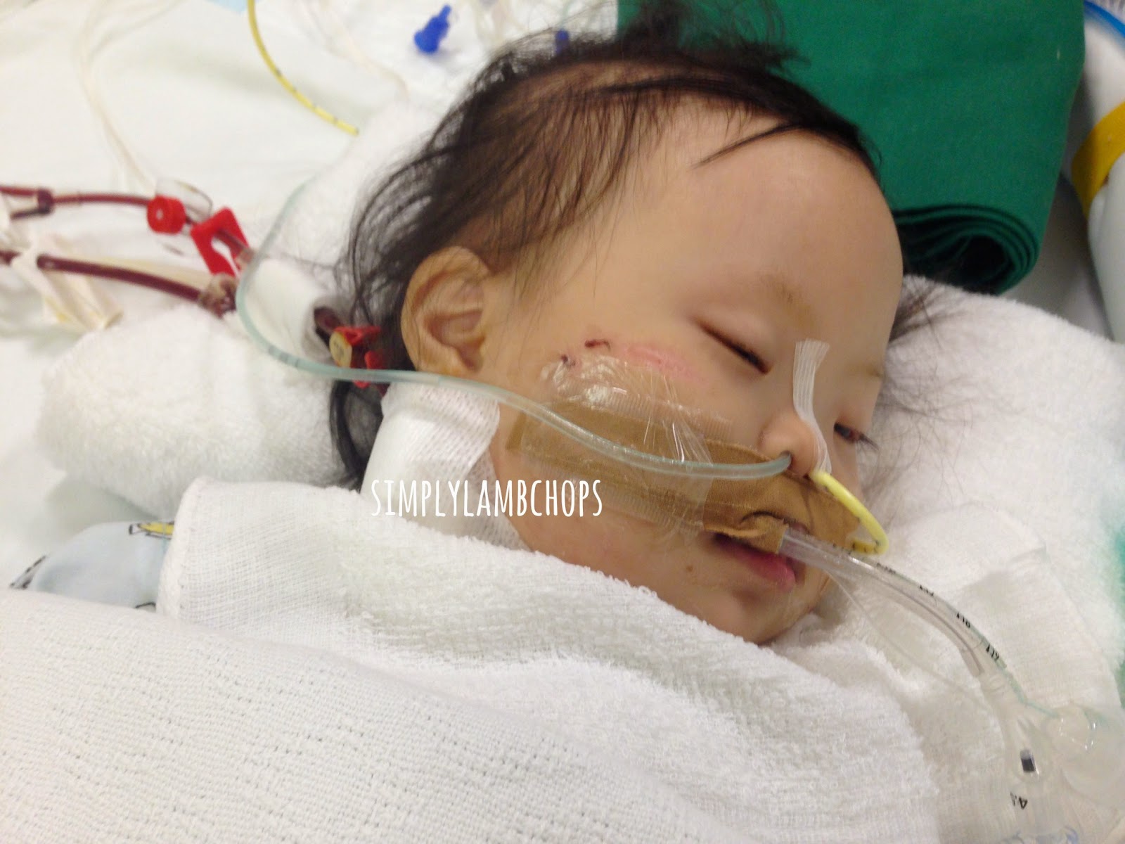 All about K: Our ECMO survivor! - Simply Lambchops