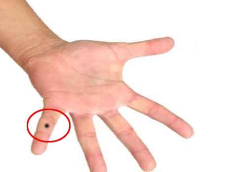 Mole On Little Finger On Hand Palmistry ~ INDIAN PALMISTRY | PALM ...