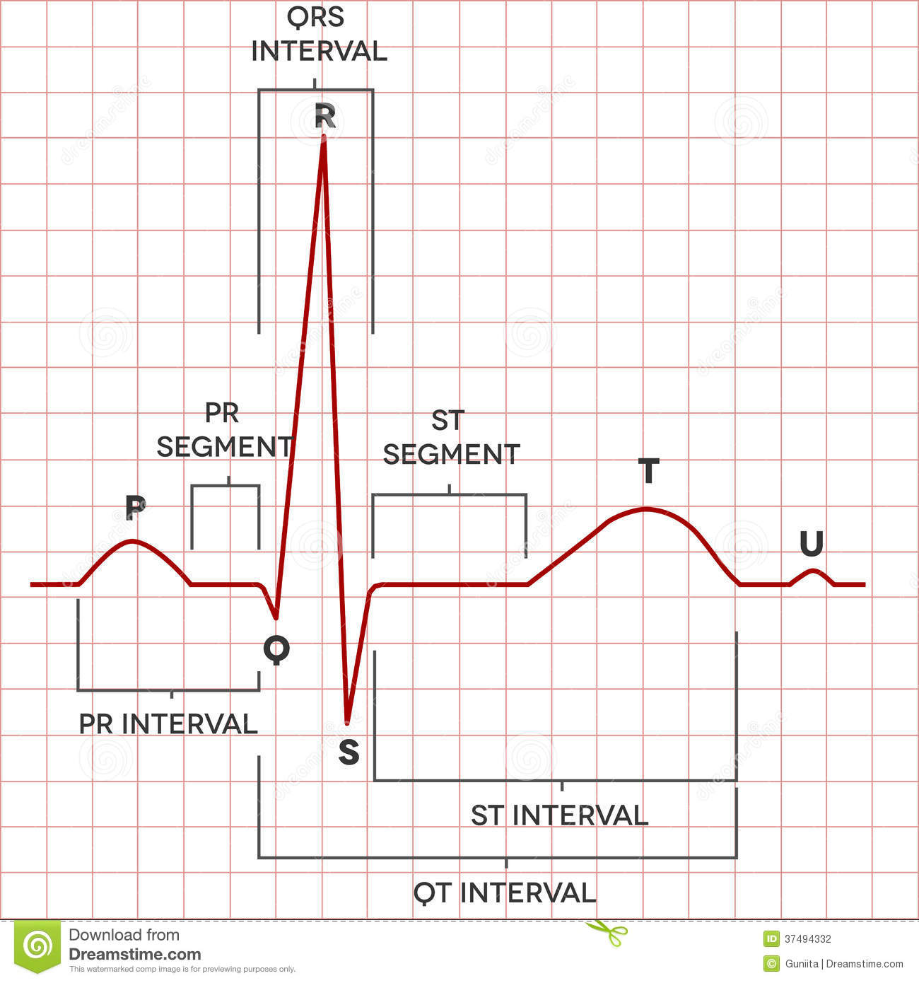 Medicina humana: Electrocardiograma