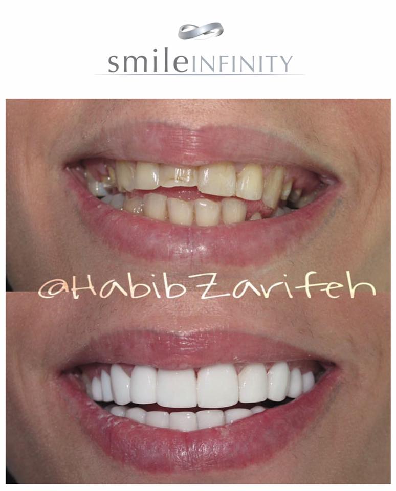 Hollywood Smile Lebanon Elite dentists at CMC Hospital affiliated with ...