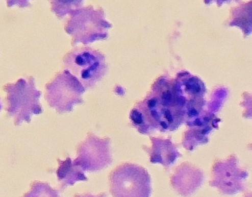 VETERINARY PARASITOLOGY: BABESIOSIS