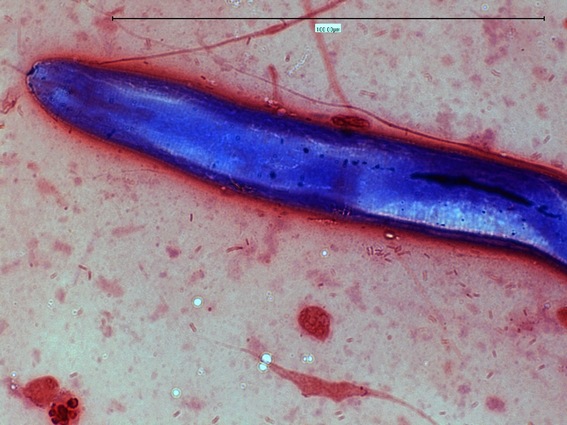 Fun With Microbiology (What's Buggin' You?): Strongyloides stercoralis ...