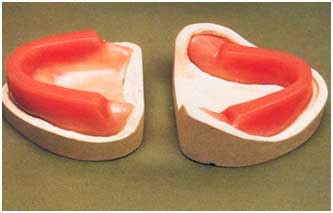 COMO HACER UNA PROTESIS DENTAL