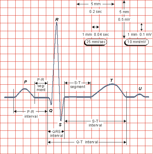 Sinyarma Arveduion: ECG for dummies (3/?) - El ECG normal
