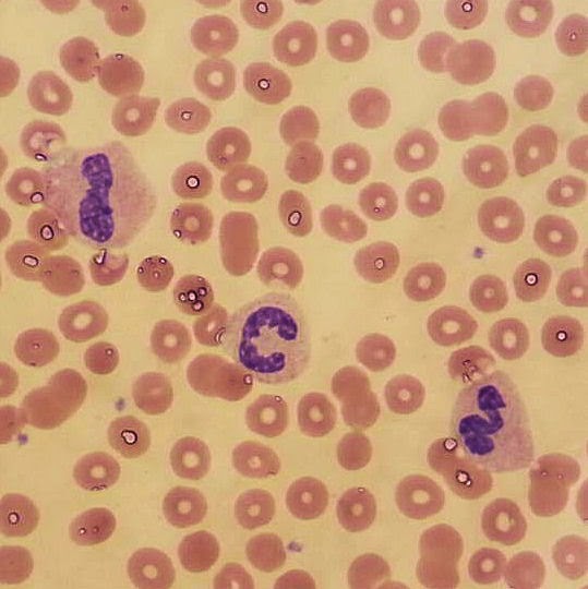 Medical Laboratory and Biomedical Science: A Very Cool Blood Smear