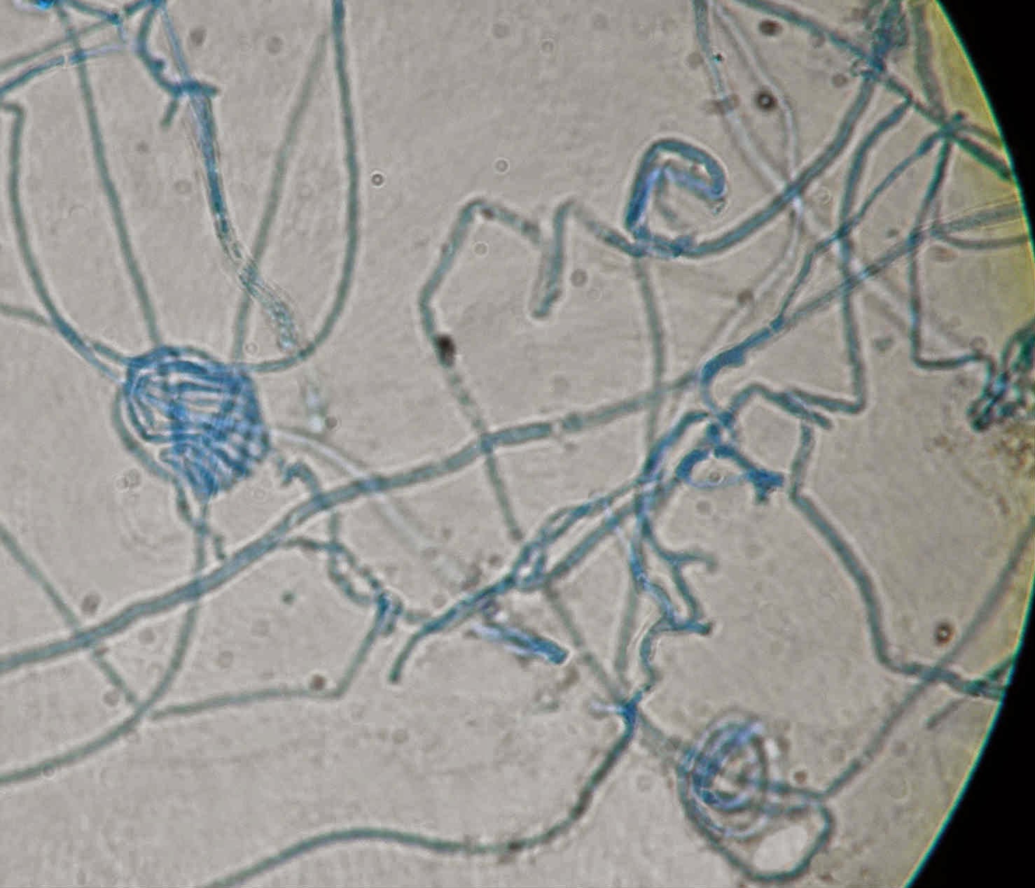 ATLAS MICOLOGIA: TRICHOPHYTON INTERDIGITALE VARIEDADE NODULAR