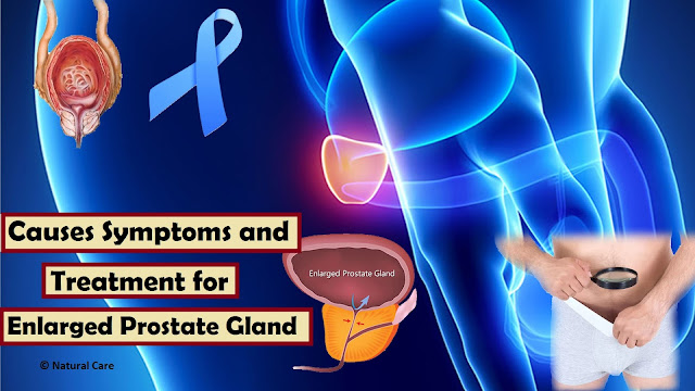 Causes Symptoms and Treatment for Enlarged Prostate Gland | Education ...