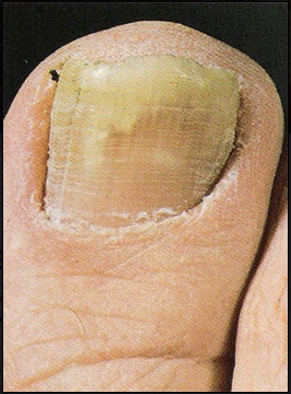 Milene Veloso Make Up: A saúde das unhas.