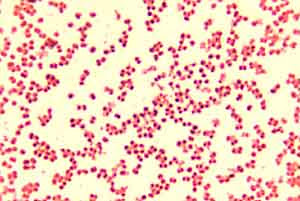 BACTERIOLOGIA: AEROBIOS