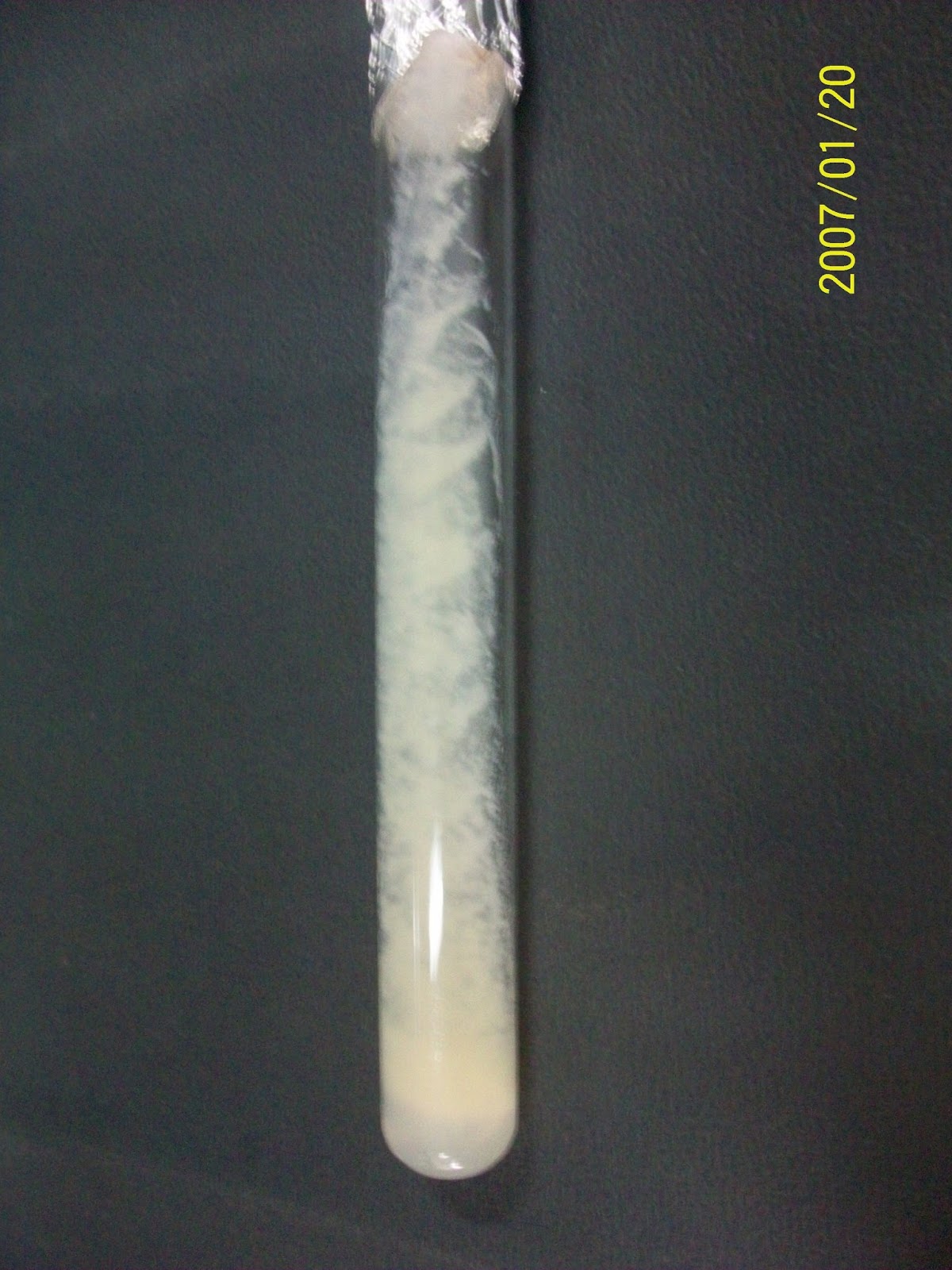 PERCOBAAN IV Mikrobiologi - Isolasi dan Penanaman Mikroba ( Praktikum ...