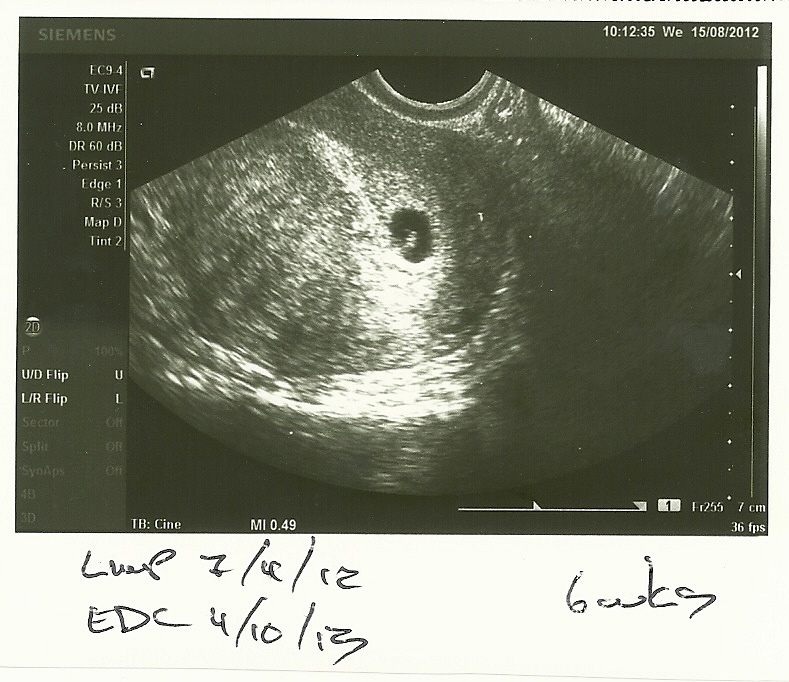 Refrigerator Memories: 6 Week Belly Bump