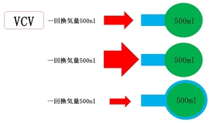 VCVとPCVの違いと使い分け-臨床工学技士による呼吸療法勉強会