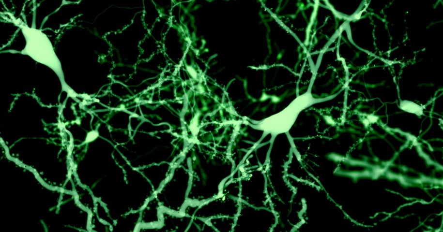 Our Parkinson's Place: Deterioration of Nerve Cell Structure Not the ...