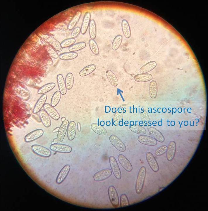 Misidentifying Fungi: March 2017