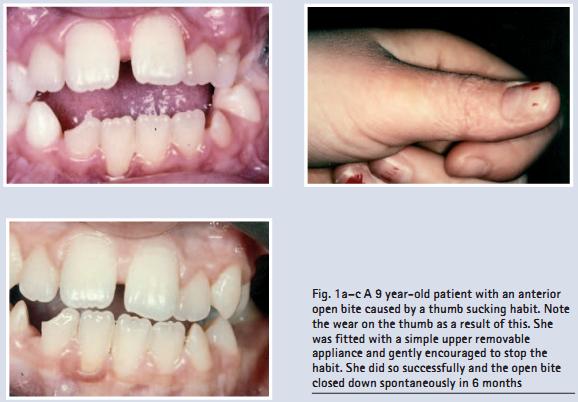 Dentistry lectures for MFDS/MJDF/NBDE/ORE: An Illustrated Note on ...