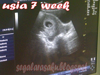 Usia kehamilan 7w2d