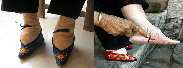 Practice of bound feet in China | TVOKM