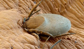 Puukentsefaliit | PUUK & PUUGIINFO