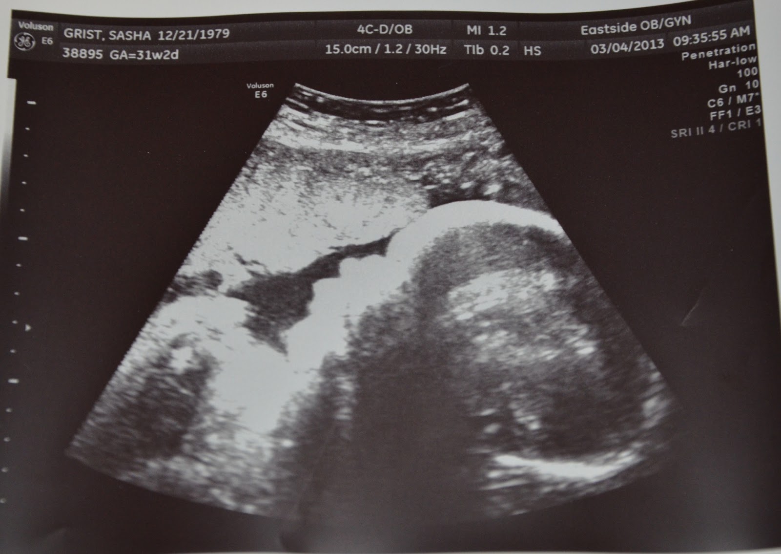And Then There Were Five!: 31 Weeks Ultrasound