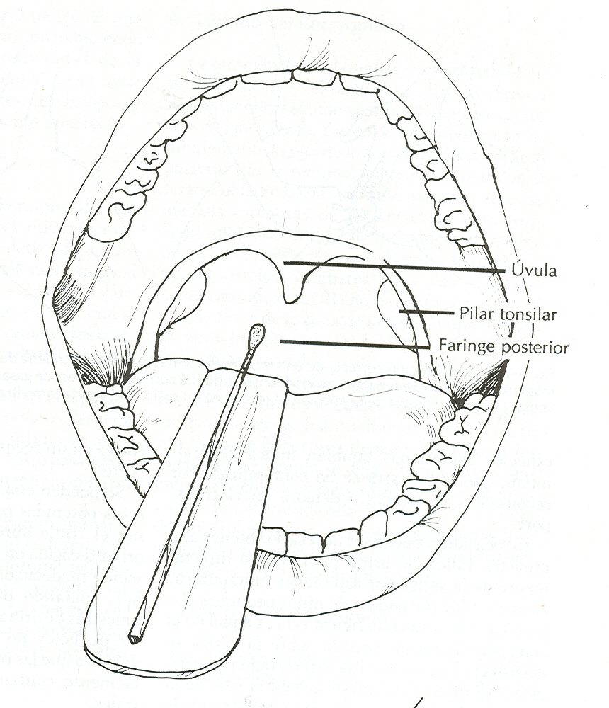 SUBMODULO :TOMA DE MUESTRAS BIOLOGICAS: PRACTICA DE LABORATORIO: TOMA ...