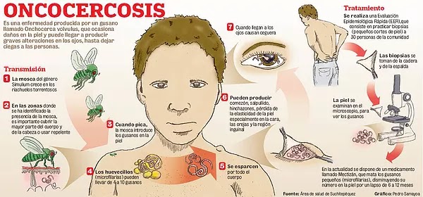 PARASITOLOGÌA - P4 - JOSÈ YENCHONG: PREVALENCIA DE LA ONCOCERCOSIS EN ...