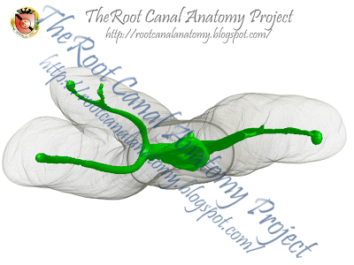 The Root Canal Anatomy Project: Three-Rooted Maxillary First Premolar