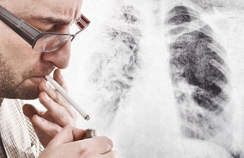 Blog en Salud para Pacientes: EL TABAQUISMO, UNA ENFERMEDAD DESCONOCIDA