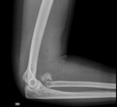 Ortopedia Adultos: julio 2013