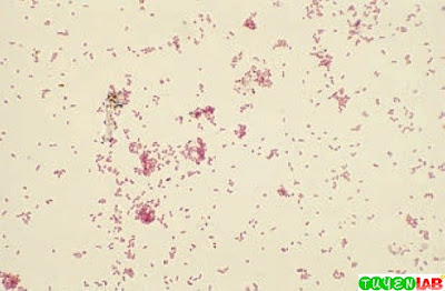 [Microbiology] Atlas of Haemophilus and Other Fastidious Gram-Negative ...