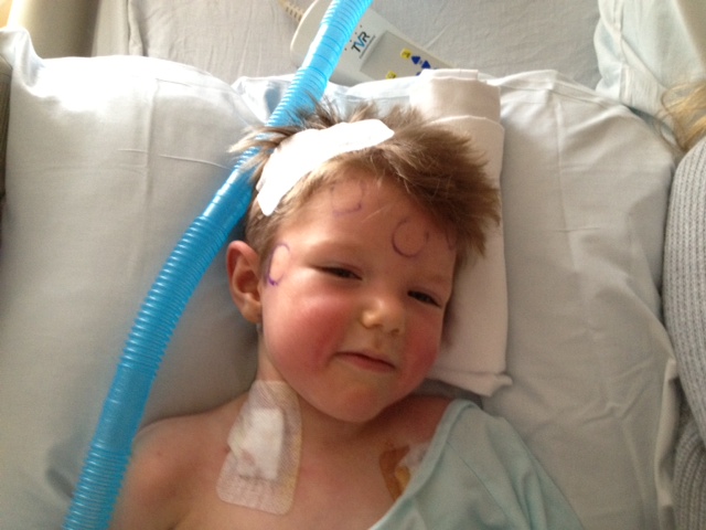 Preschool and shunt surgeries