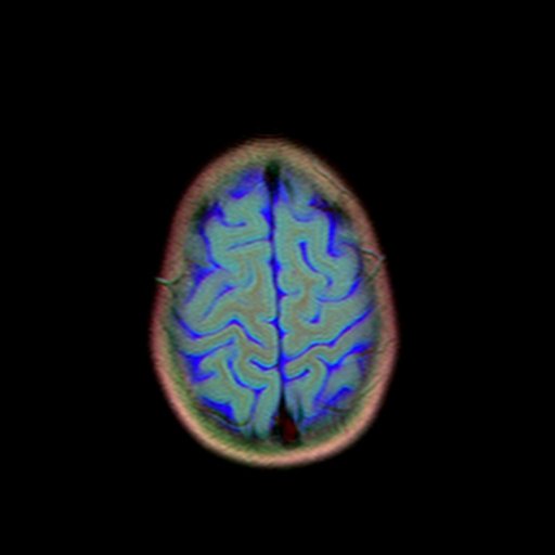 Nevit's blog: Color MRI of the Brain