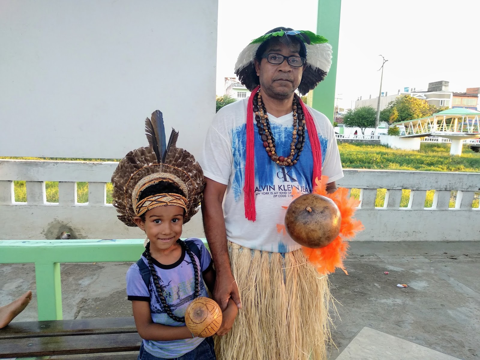 Jacobina. Após cirurgia, índio Payayá luta há mais de um ano para fazer ...