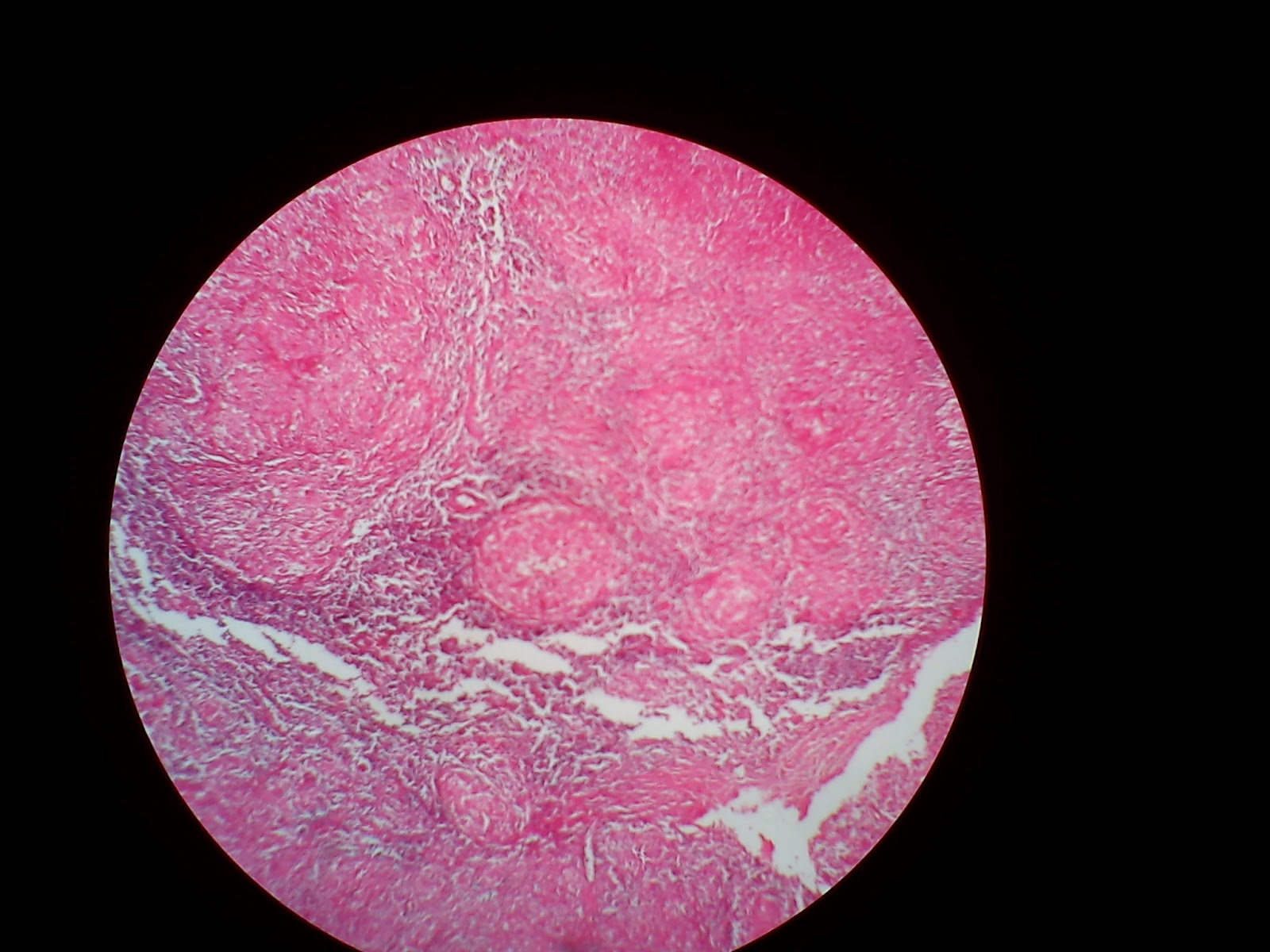 Ca - CaDo (Catatan Calon Dokter): Blok 11 : Praktikum Patologi Anatomi ...