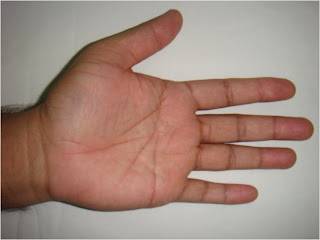 Unusual (Rare Lines & Shapes) Palm Image | INDIAN PALMISTRY ~ INDIAN ...