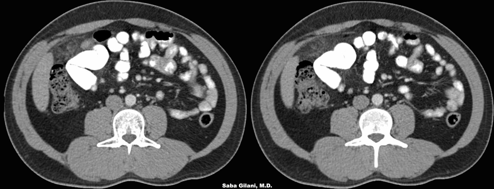Roentgen Ray Reader: November 2012