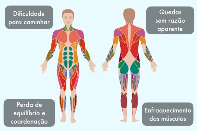 Eu antes e depois da Doença (doença neuromuscular): Distrofia Muscular