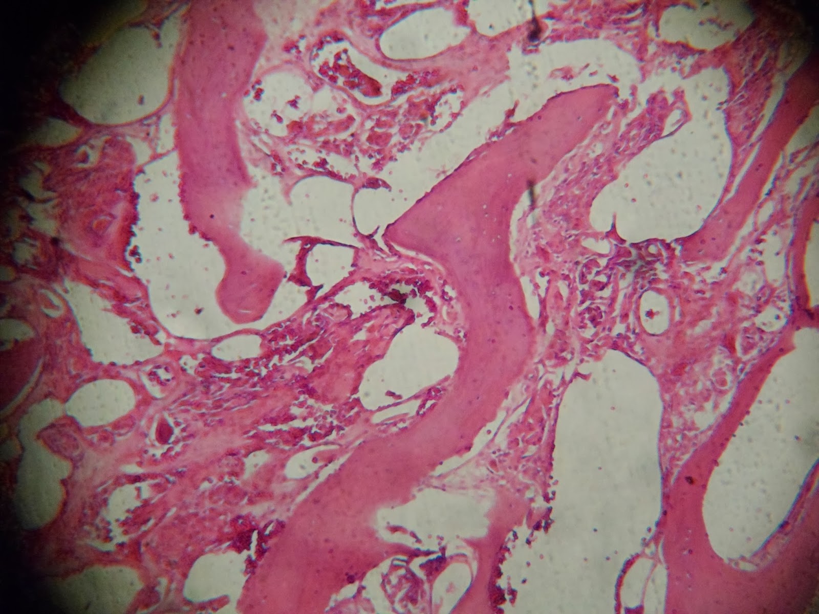 LA GALERÍA MICROBIOLÓGICA: Hueso Esponjoso