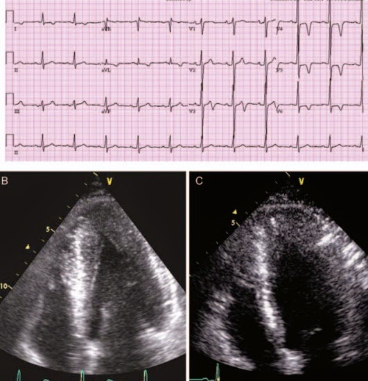 Dr.Nabil Paktin's Journal of Cardiovascular Medicine Blog ژورنال ( قلب ...