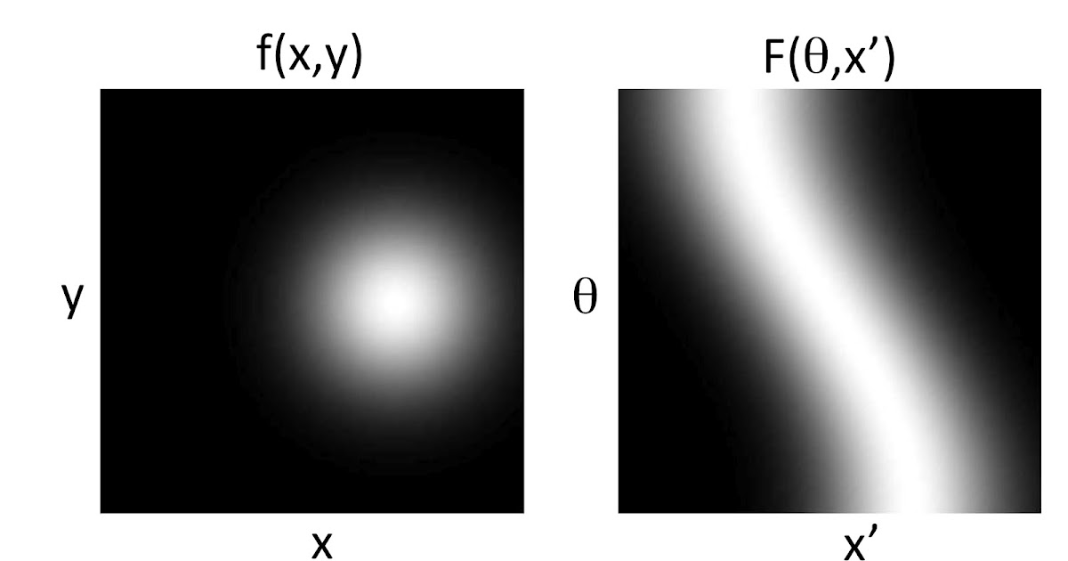 Intermediate Physics for Medicine and Biology: The Sinogram