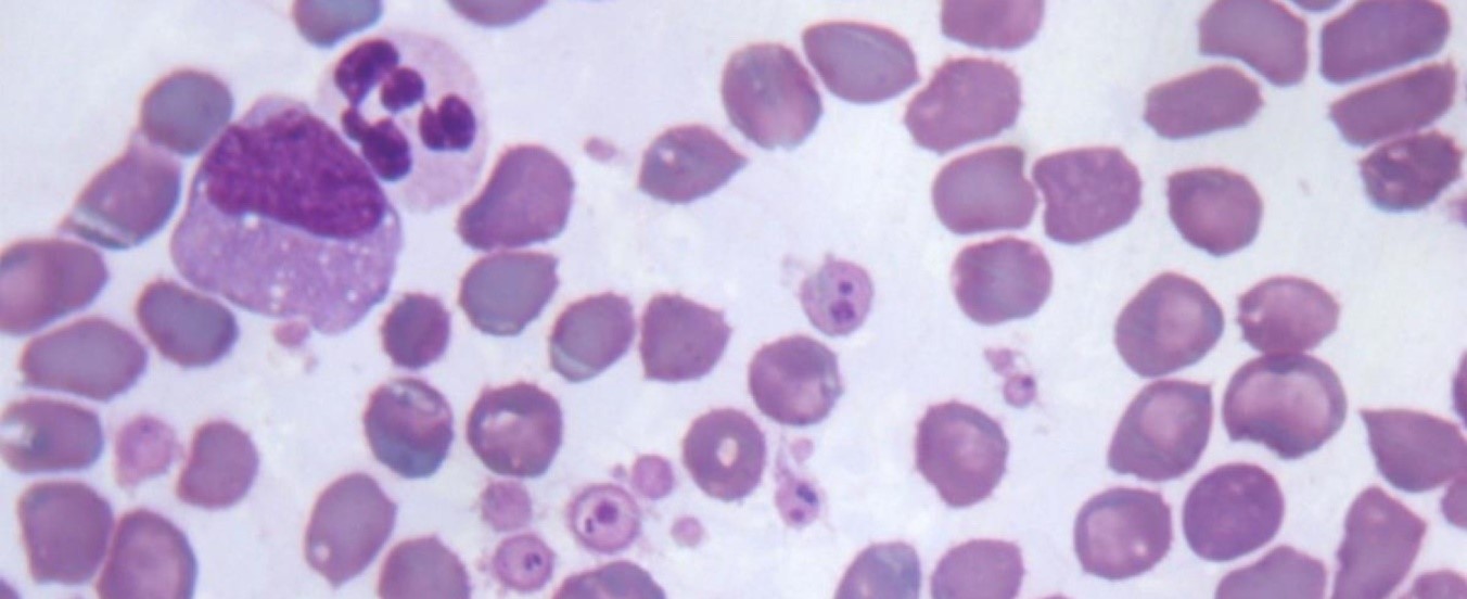 5 Cosas que no Sabias de Ehrlichia - Puerto Rico Loves Biology